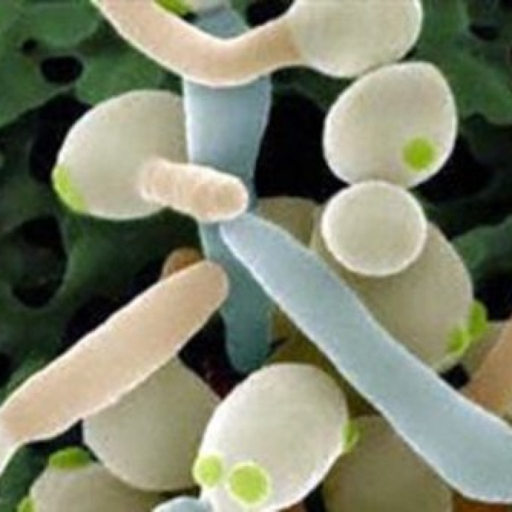 candidose - Objectif Detox